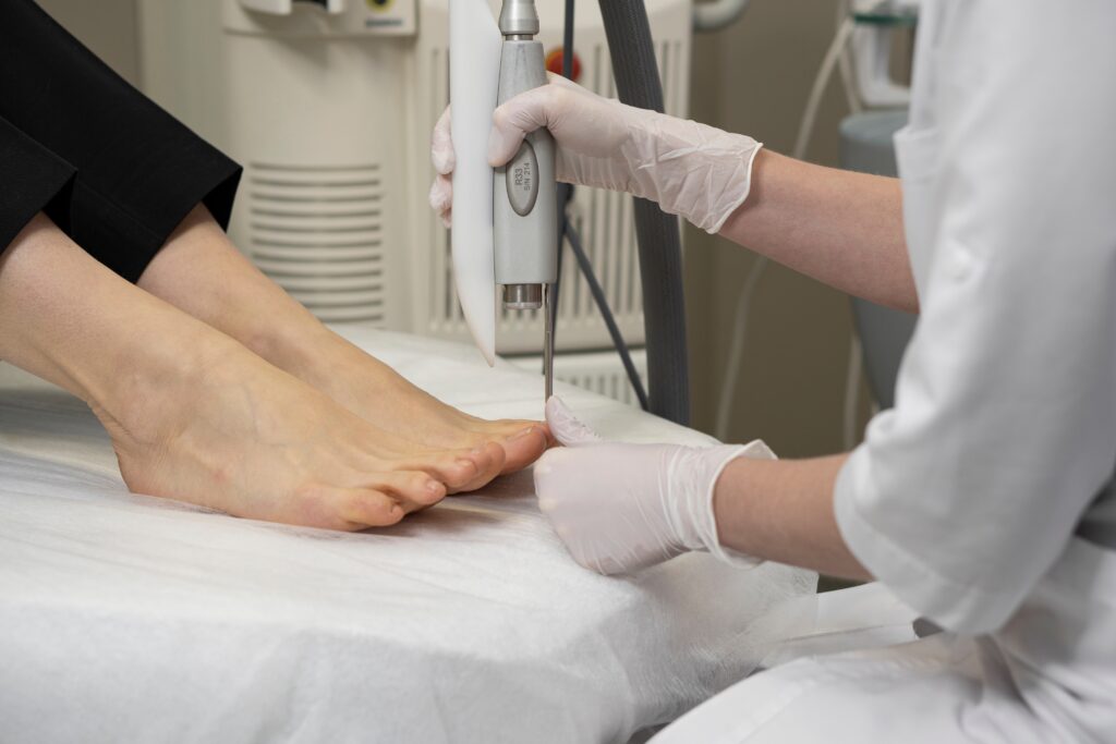 Oνυχομυκητίαση - Derma Laser Clinic